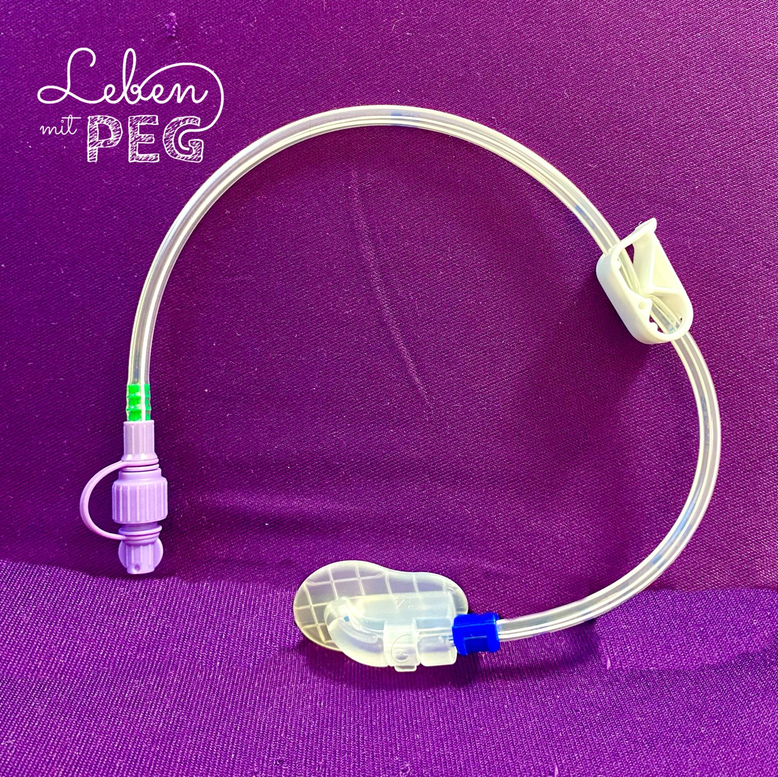 PEG-Sonde: Vor- und Nachteile im Überblick - Leben mit PEG PEG-Sonde: Vor- und Nachteile im Überblick - Leben mit PEG